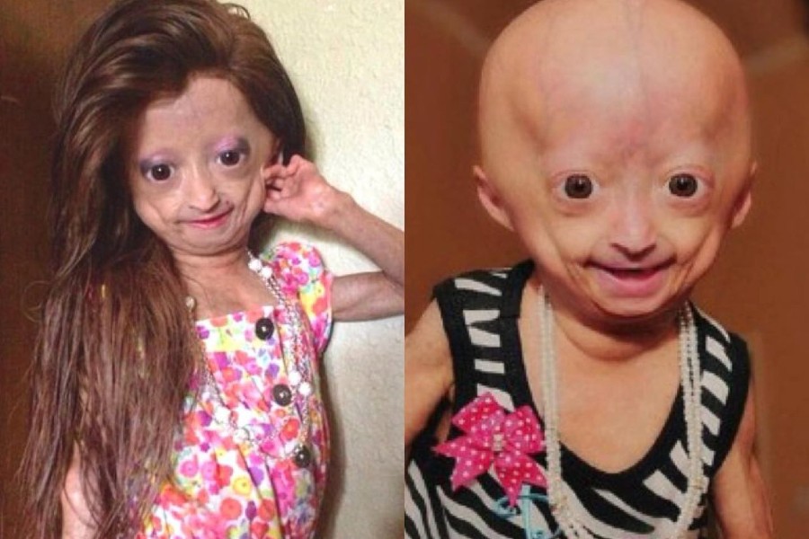 Adalia Rose Et
