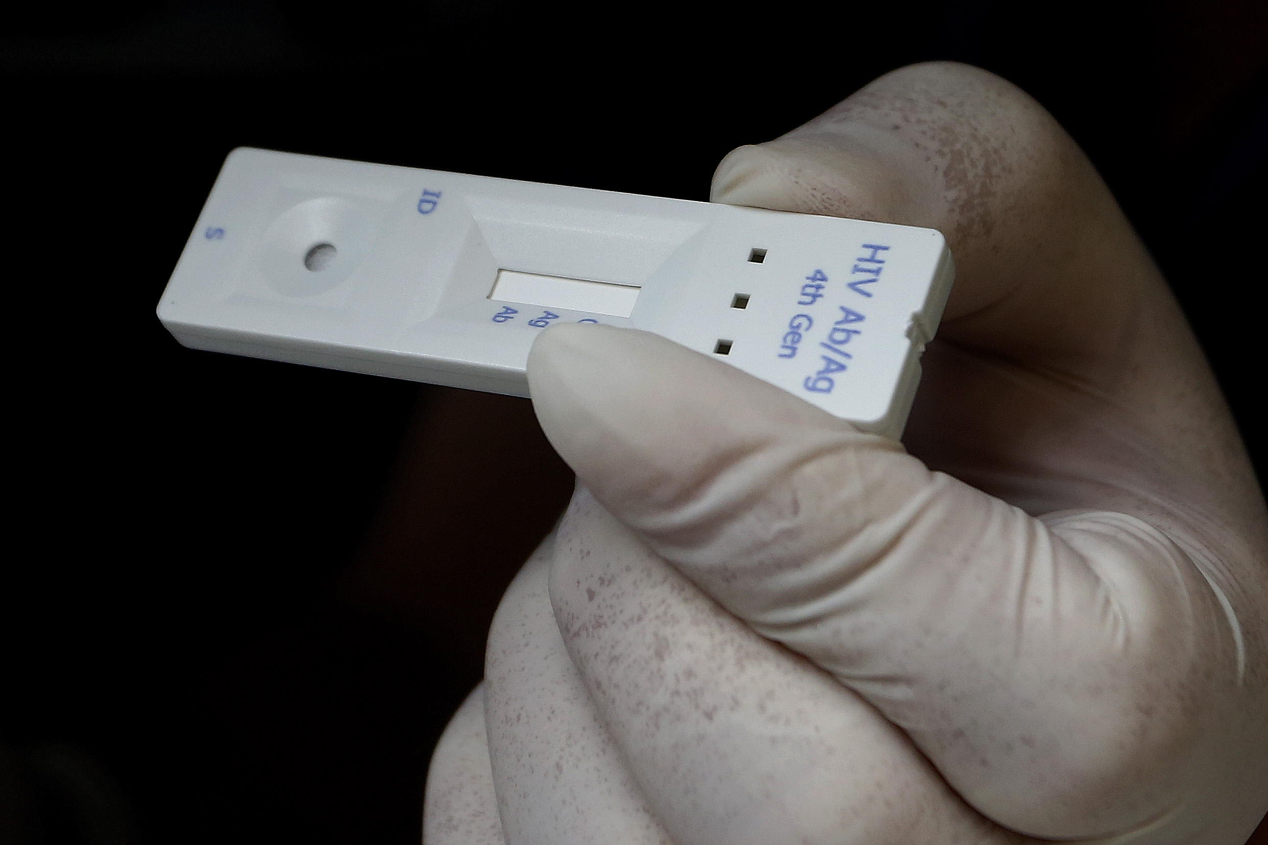 Aumento de VIH: Chile en el contexto latinoamericano